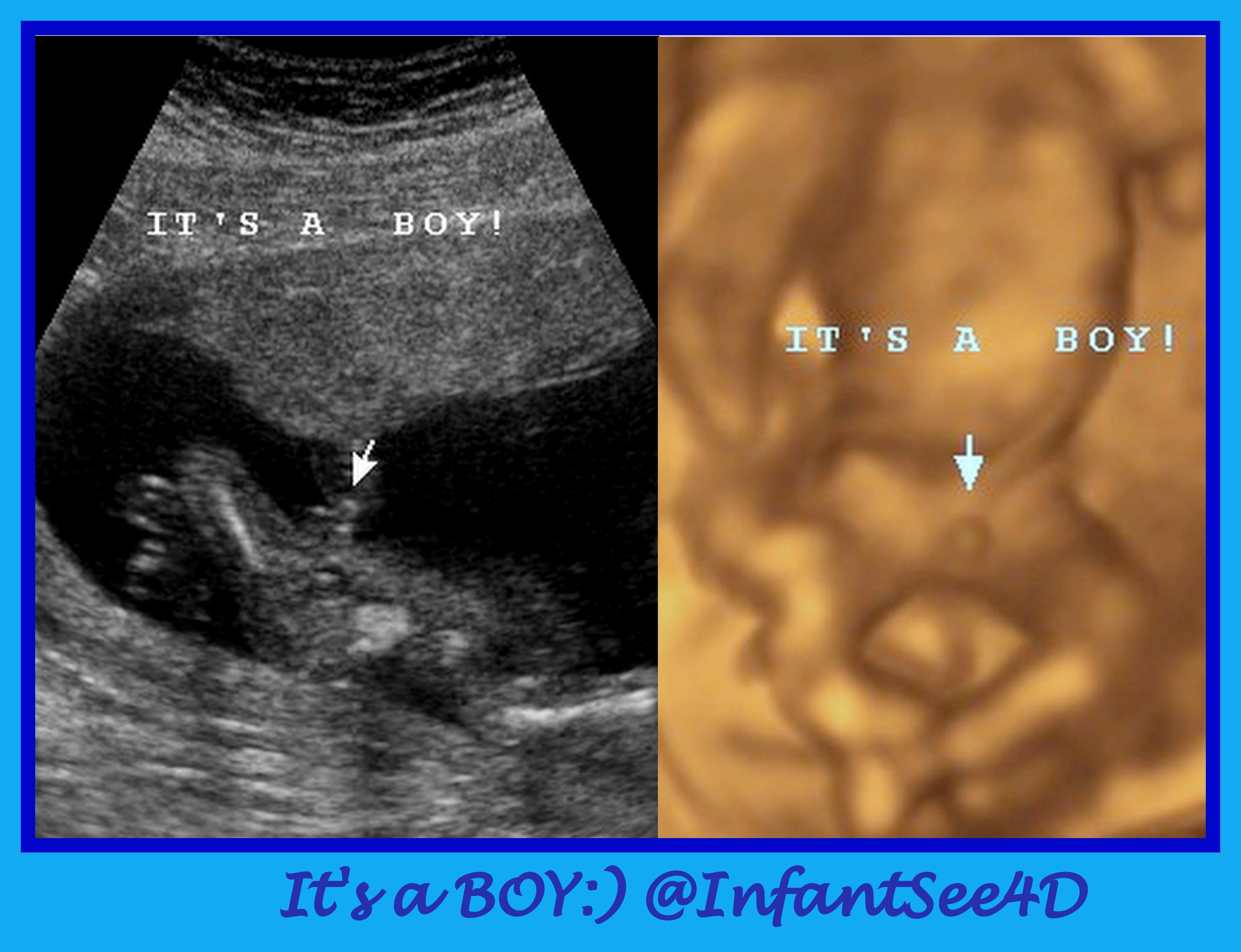Kimberly s Journey Of Motherhood 3D 4D HD Ultrasound VA Kimberly s Journey Of Motherhood 3D 4D HD Ultrasound VA