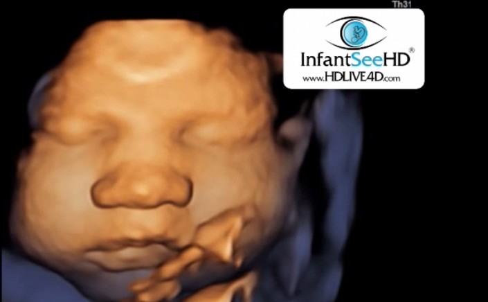 Exclusive HD Ultrasound Series - Virginia's Detailed View