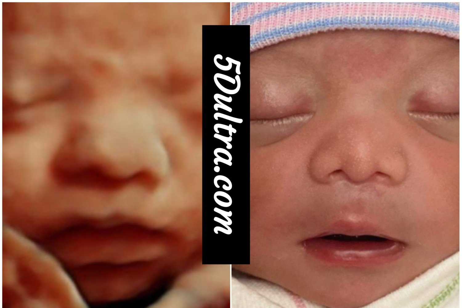 25 Week Ultrasound 3D | 3D 4D HD Ultrasound Virginia