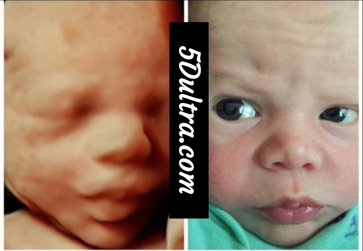 3D Sonogram 12 Weeks | 3D 4D HD Ultrasound Virginia