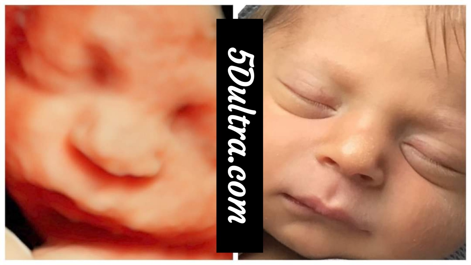 When Is Best Time to Do 4D Ultrasound | Ultrasound Virginia