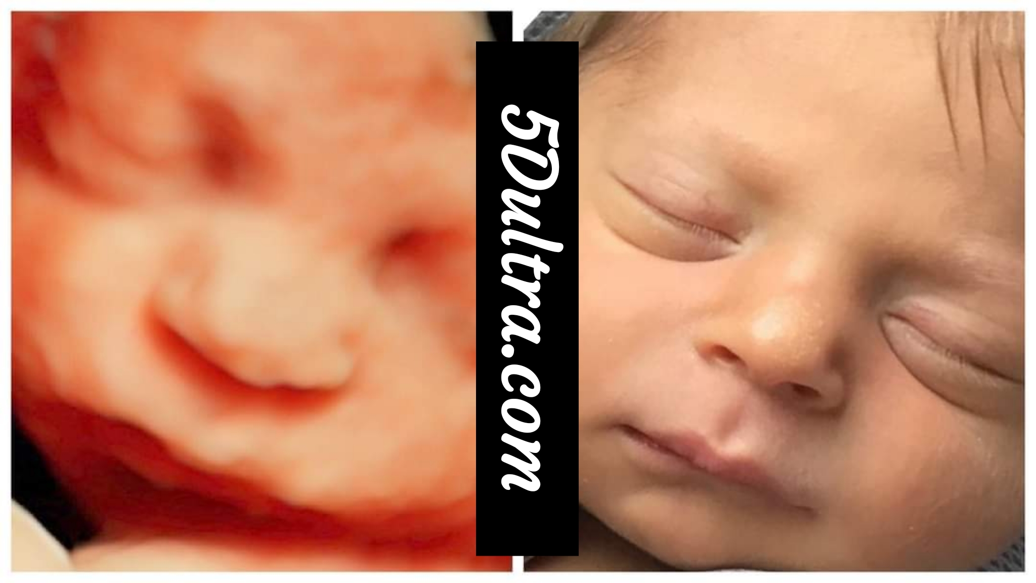 See The Difference 5D Baby Scan Transformations Revealed See The Difference 5D Baby Scan Transformations Revealed