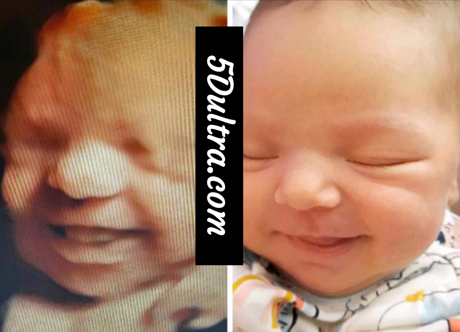 Witness the Miracle: 5D Baby Scan Before and After | 3D 4D